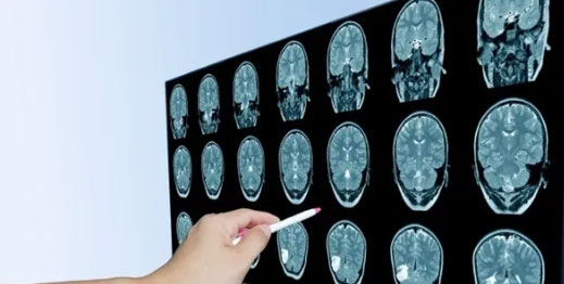 Mert Autism Houston - MIP Care